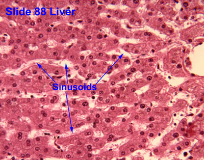 Hepatic Sinusoids
